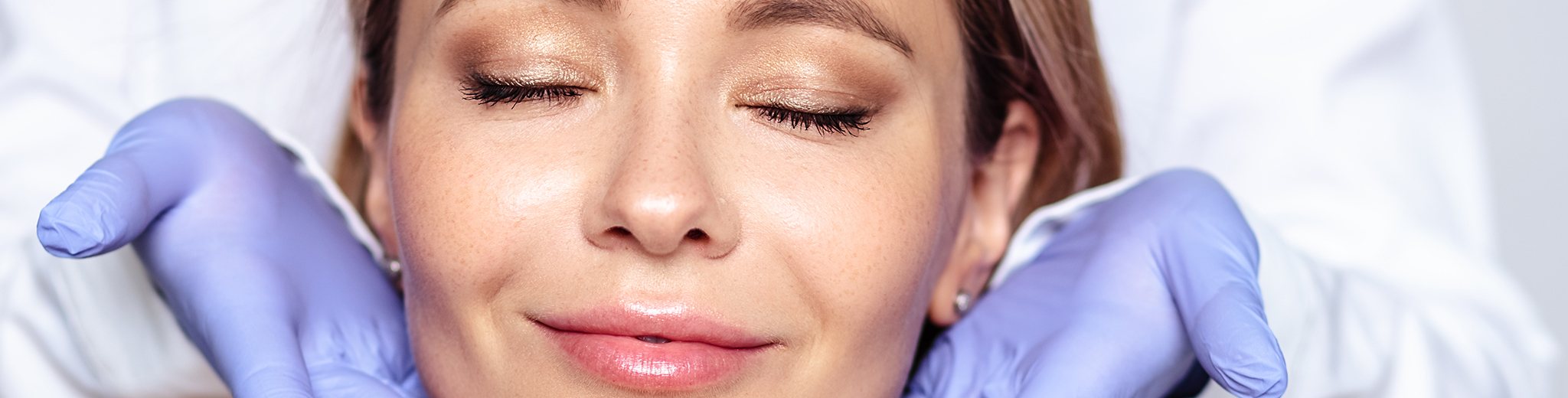 Exceed Microneedling - Bella Derma