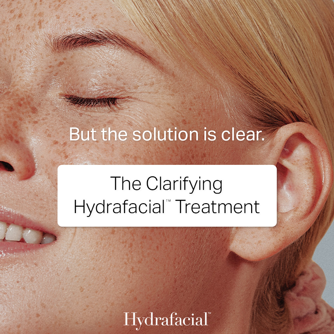 HydraFacial MD® - Bella Derma